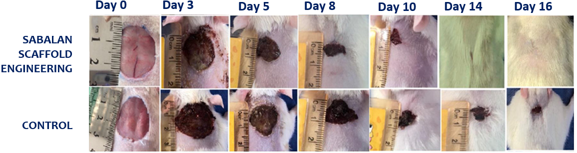 sabalanscaffold – Absorbable Regenerative Wound Dressing